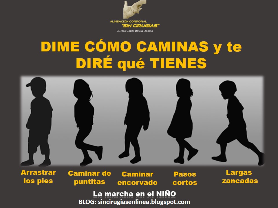 SIN CIRUGÍAS en LÍNEA: CAMINANDO y TU SALUD