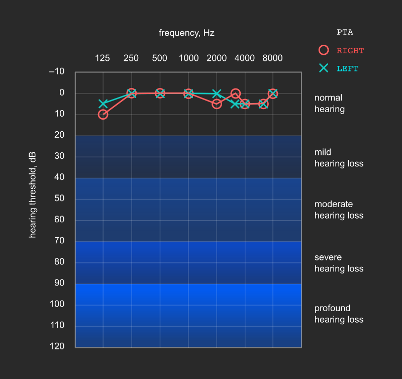 absorptions: Case study: tinnitus with distortion