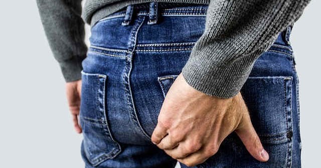 Pilonidal cyst on the butt: Get rid of the pilonidal cyst!