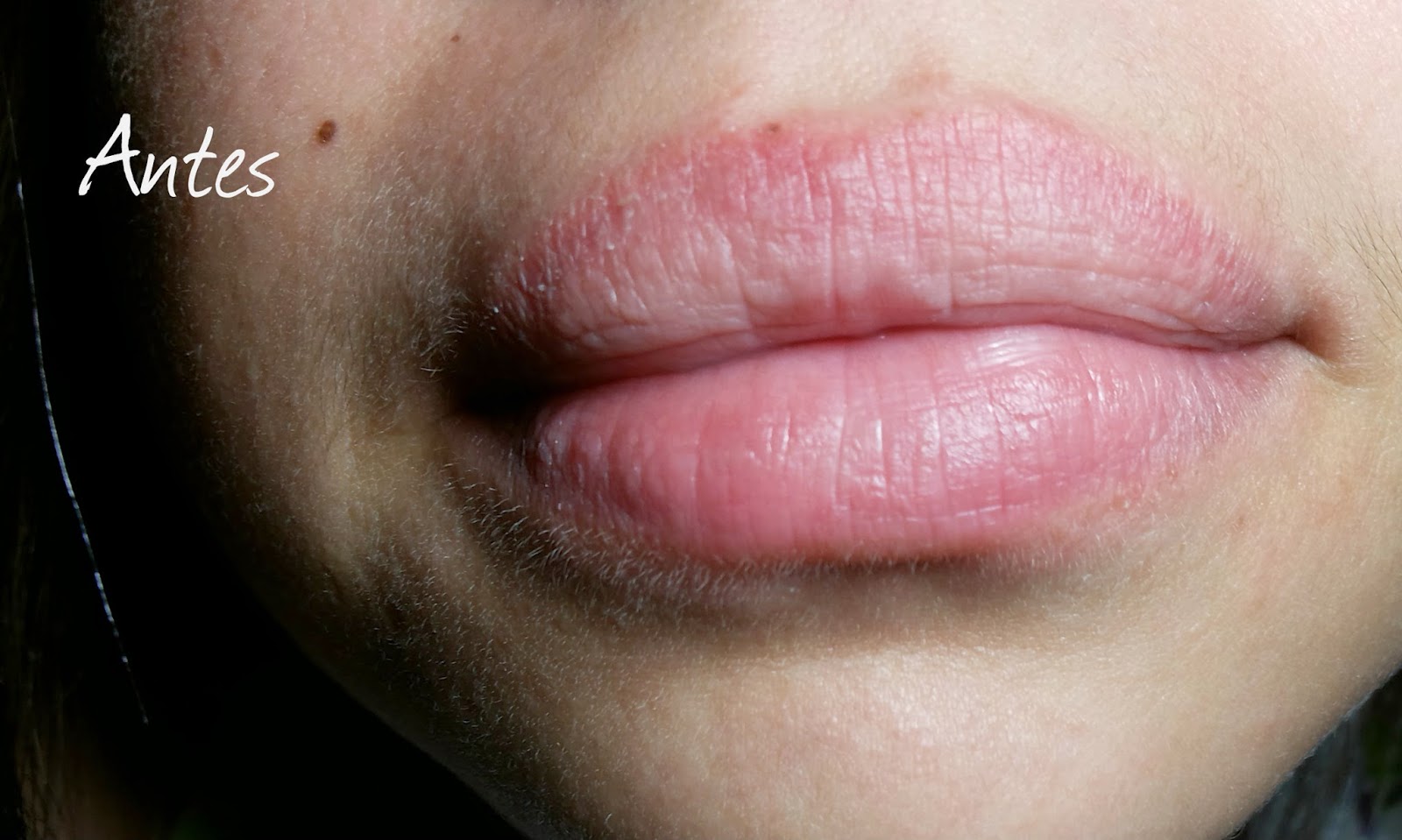 Diversos Femininos | Natália Viana: Dica :Boca queimada ou ressecada ...