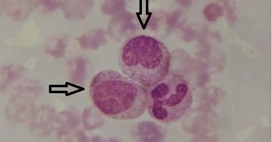 Fichero de Hematología: Mielocito