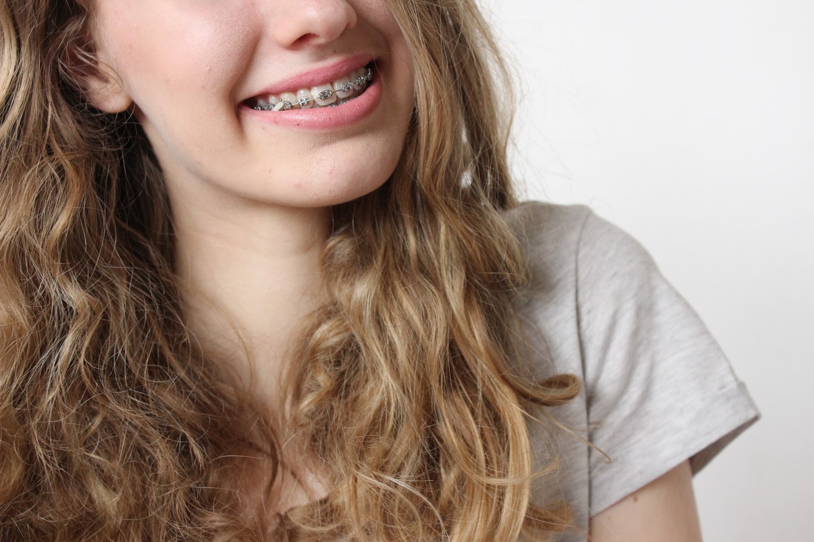 Story time #2 Mijn ervaring met een beugel | Inspiregirll