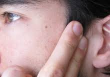 Ramin Mehregan D.M.D.: TMD and the EAR and EYE Connection