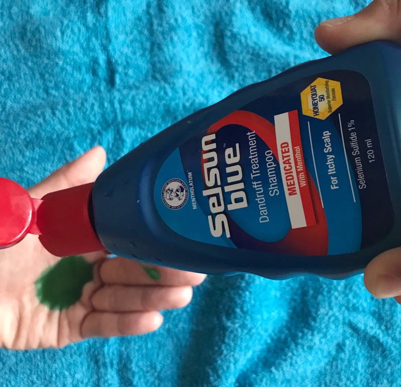 The Truth about Dandruff and How to treat it with Selsun Blue ...