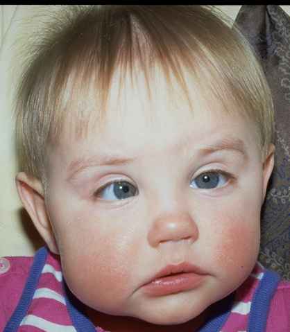 my eyes is the mirror of my heart: Conditions diagnosed during eye ...