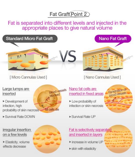 ID Hospital Korea: ID Hospital's NANO Fat Graft