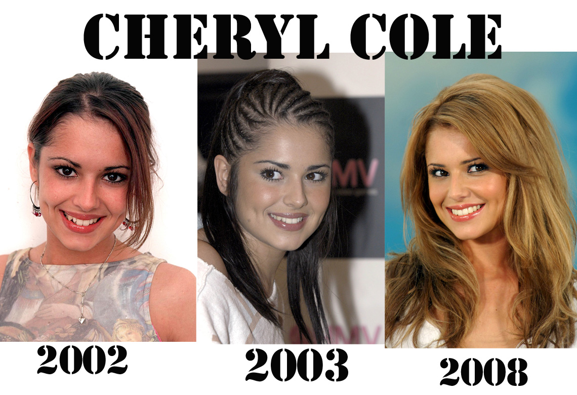Cheryl Cole Plastic Surgery Before And After Nose Job And Botox Injections Star Plastic Surgery