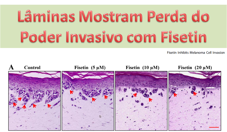 Saúde & Ciência: FISETINA e a FAMÍLIA FLAVONÓIDE