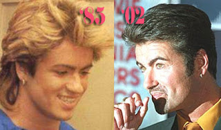 George Michael Plastic Surgery Before and After Browlift ...