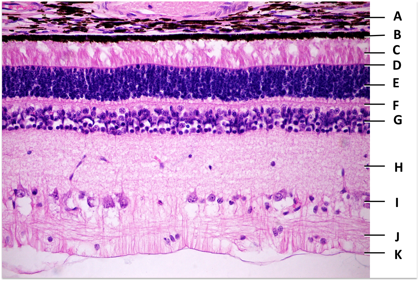 SOS BIOLOGIA CELULAR Y TISULAR: OJO. RETINA Y COROIDES. EYE. Retina and ...