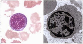 HEMATOLOGIA: ERITROBLASTO BASOFILO