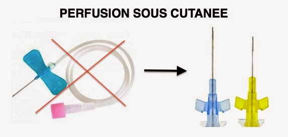 Récap' IDE: La perfusion sous-cutanée