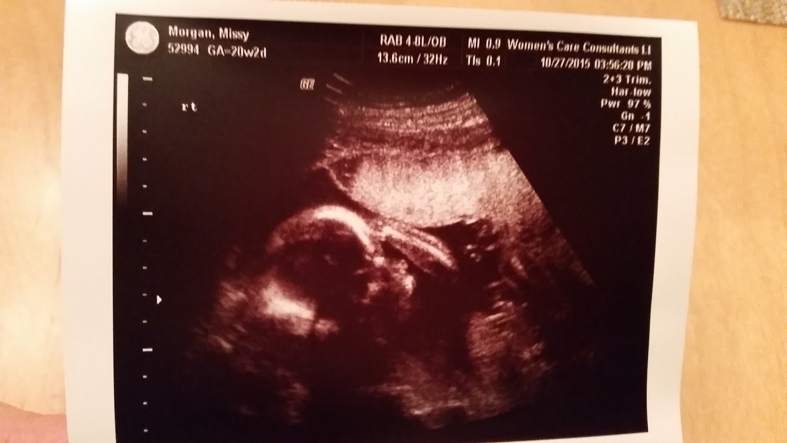 Morgan Minor Musings