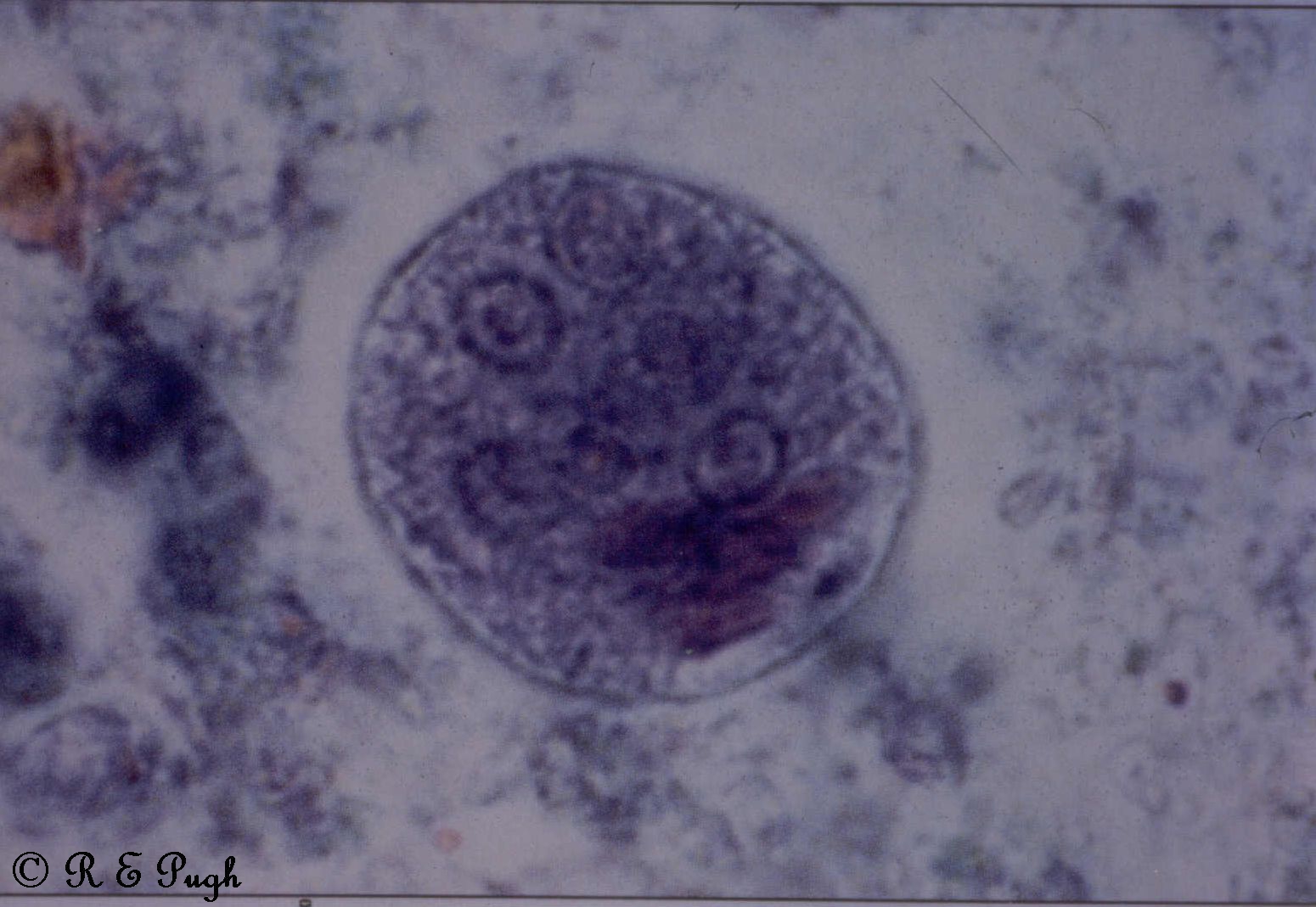 Lecture Notes in Medical Technology: Lecture #13: SUBPHYLUM SARCODINA