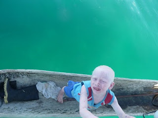 Deformutilation: Albinism Among The Kuna Indians