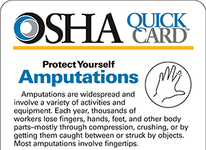 Aluminium Plant Safety: "leg was amputated...."