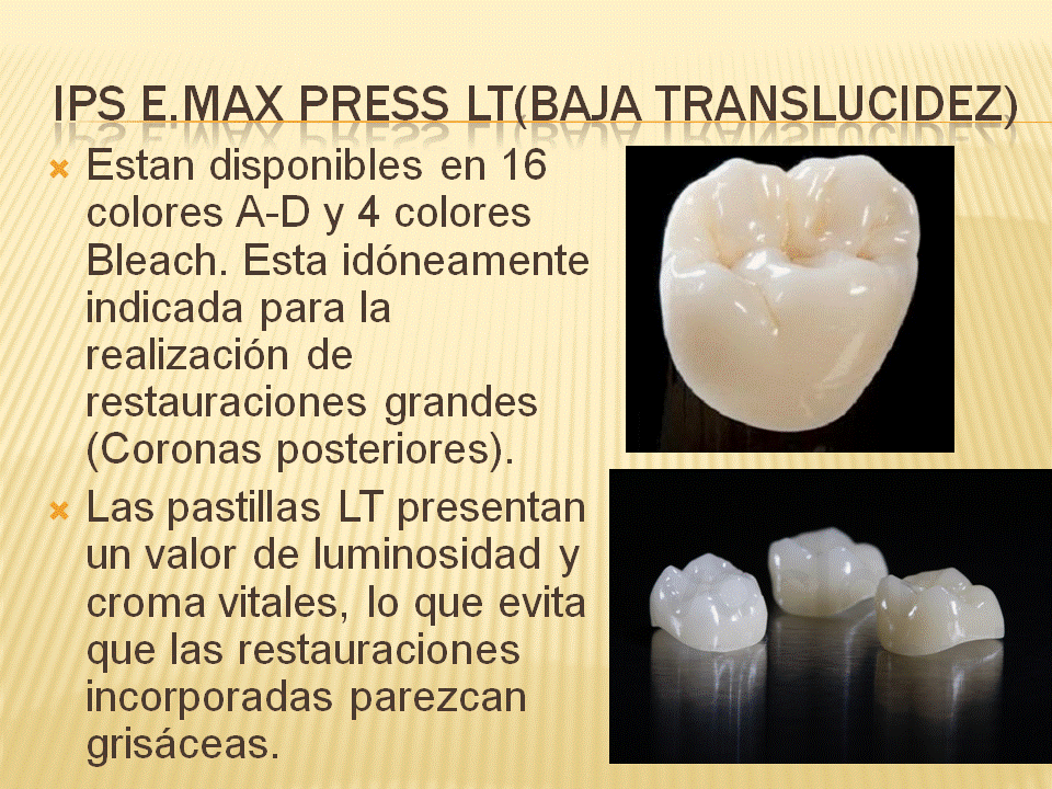 I.P.S Emax Press: 2014