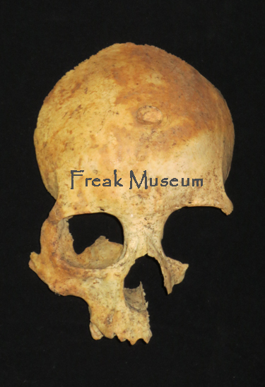 Freak Museum A Private Collection: Skulls