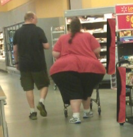 The Well-Rounded Mama: Lipedema, Part 3: Types of Fat Distribution and ...