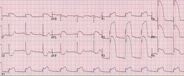 Dr.Nabil Paktin's Cardiology Blog مجله کاردیولوژی دکتور نبــیل پاکطـین ...