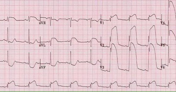 Dr.Nabil Paktin's Cardiology Blog مجله کاردیولوژی دکتور نبــیل پاکطـین ...
