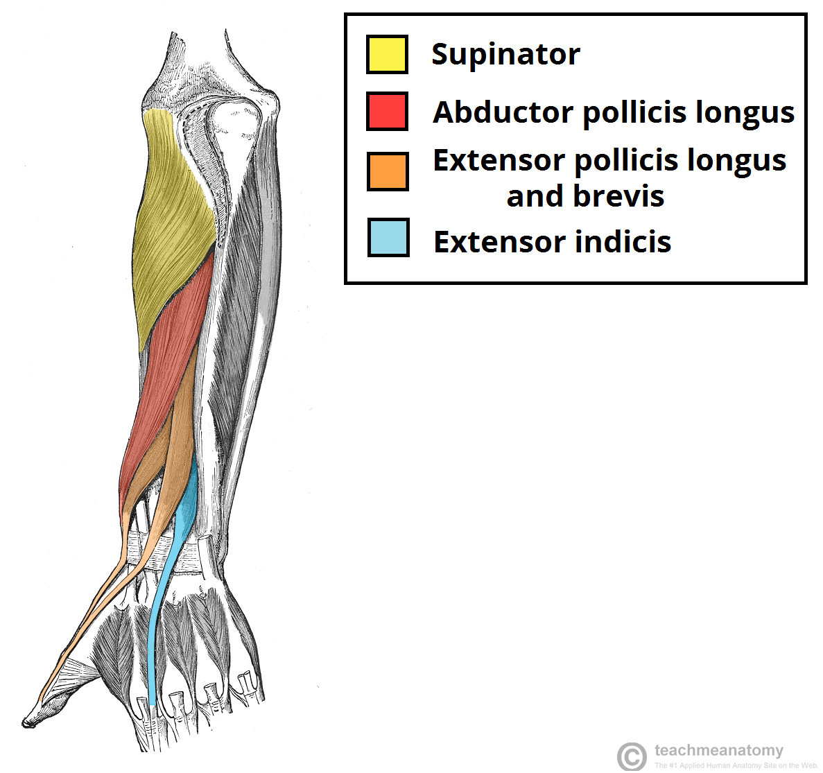 Worst Hand Forearm Injury Open fracture called Compound fracture