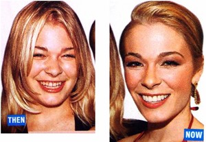 LeAnn Rimes Plastic Surgery