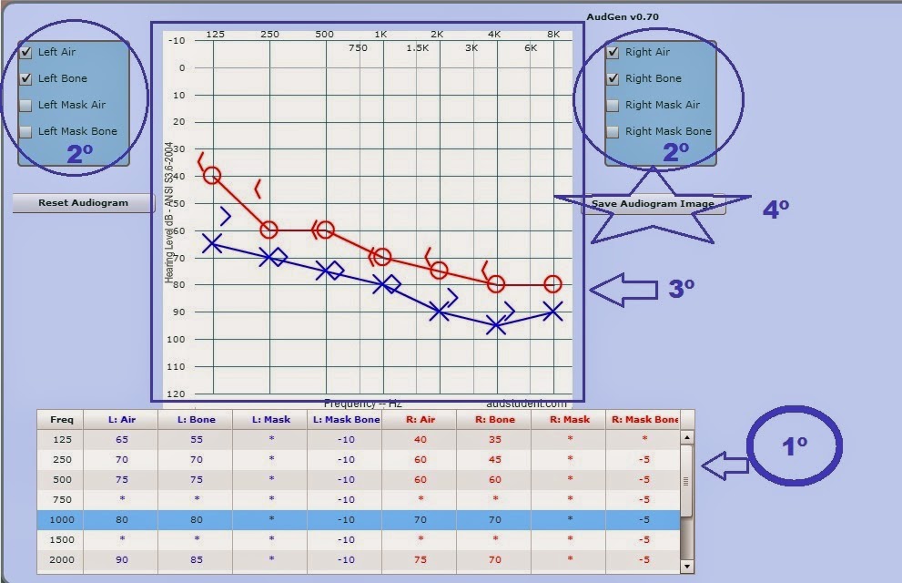 CREADOR DE AUDIOGRAMAS ONLINE!