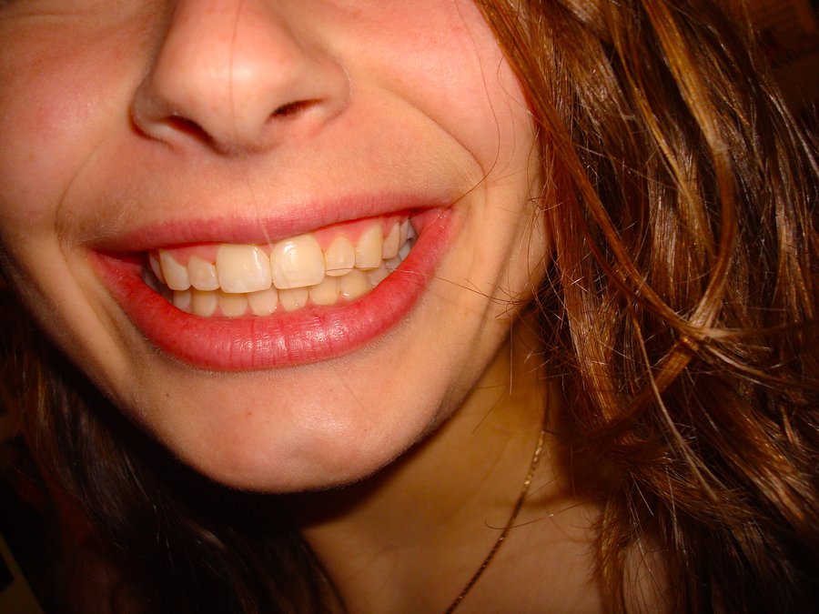 Scrimger Should Probably Be Writing Something Else