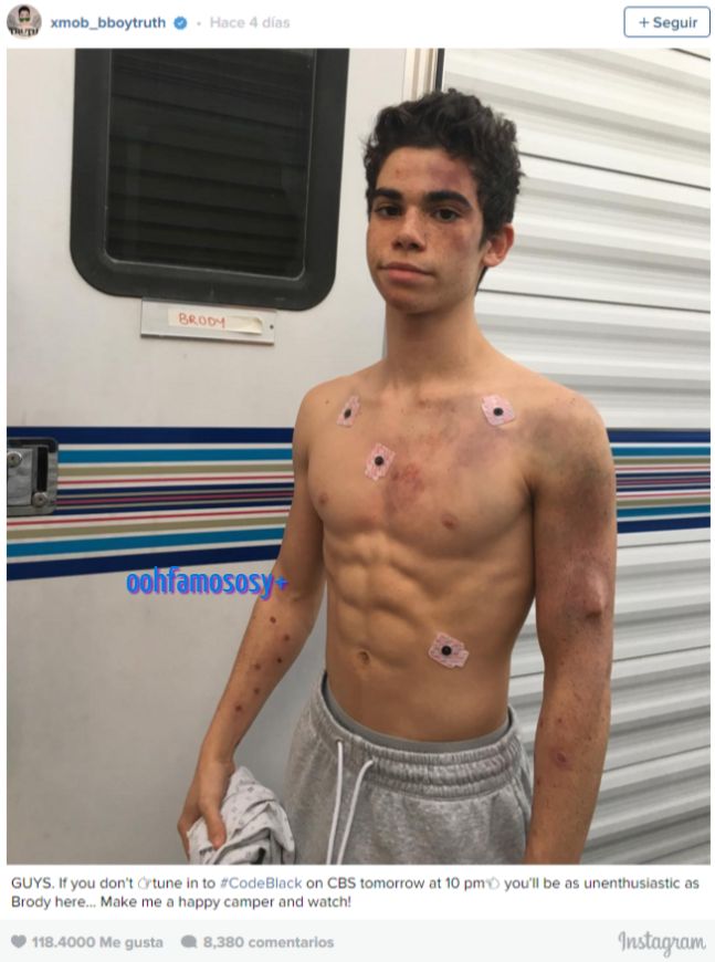 FAMOSOS&+: Cameron Boyce magullado en serie 'Code Black'