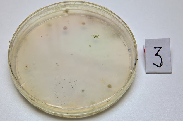 Bacteria on Extreme Macro Photography - Jefz Lim Photography Blog