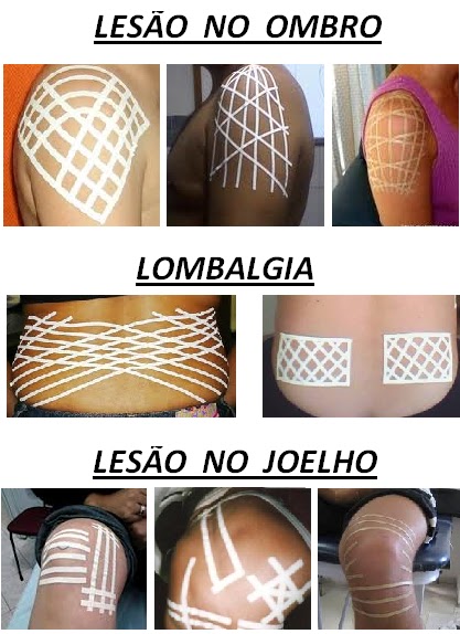 Salão de Beleza e Saúde Hikari: Spiral Taping