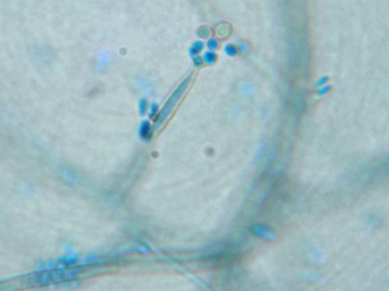 Fun With Microbiology (What's Buggin' You?): Pleruostomophora richardsiae