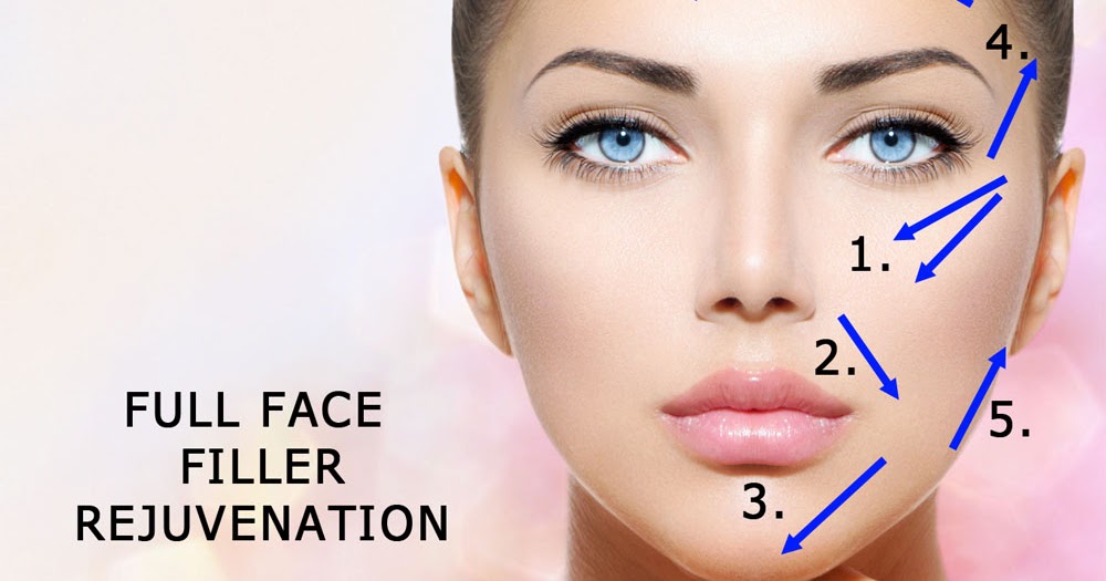 FILLER: FACIAL FILLER