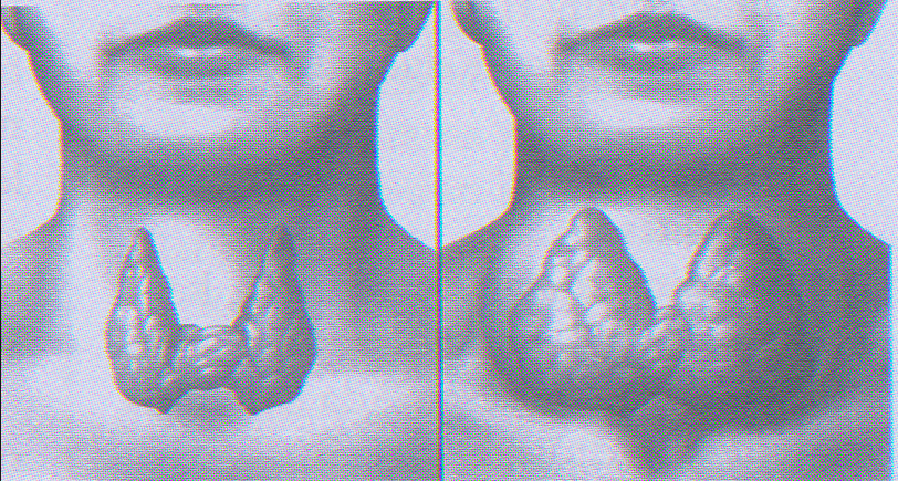 Kenali "Kelenjar Tiroid" ~ MOOD FOODY