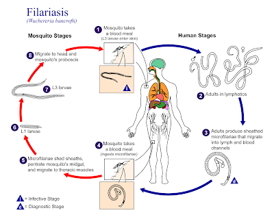 Ghalapulla: Filariasis