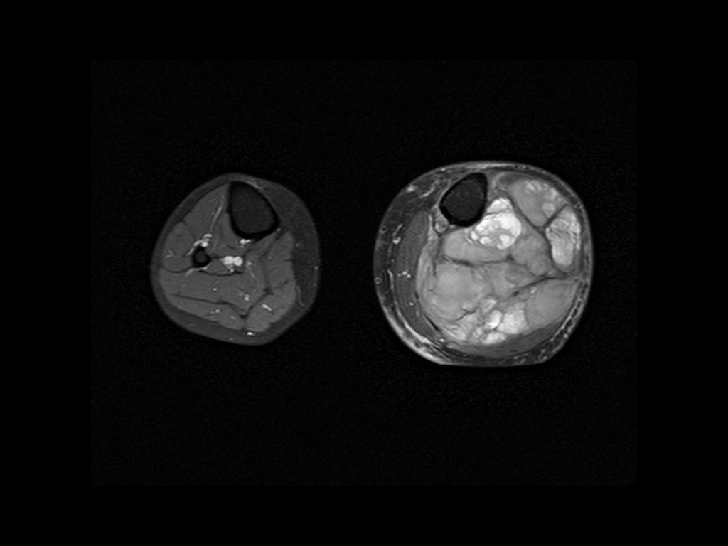 RADIOLOGIA RMC-KODA: abril 2017