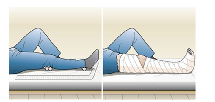 PRIMEROS AUXILIOS: TÉCNICAS DE INMOVILIZACIÓN DE UNA PERSONA