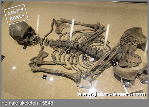 The Viking skeletons at Jorvik : Jake's Bones