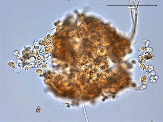 Fun With Microbiology (What's Buggin' You?): Eurotium herbariorum ...