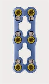 SKYLINE® Anterior Cervical Plate - SPINEMarketGroup