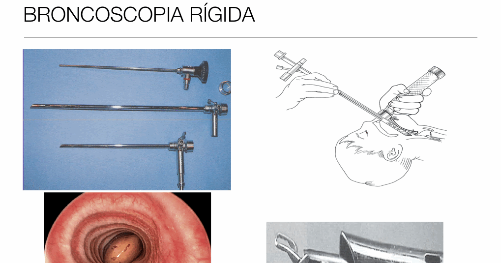 UGC-ORL HUVM: FIBROBROCONSCOPIA FLEXIBLE & BRONCOSCOPIA RÍGIDA
