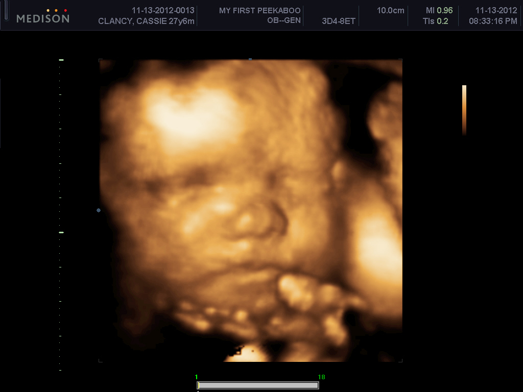 California Clancys: 28 weeks! 3D ultrasound!