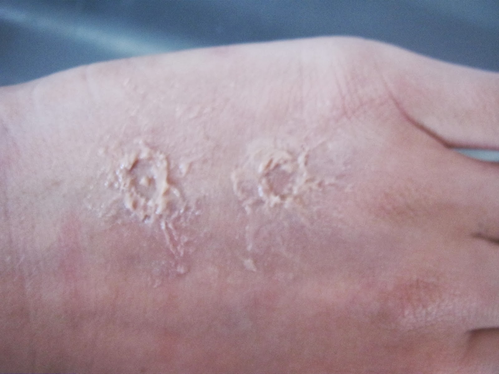 LolLoveLife: SFX make-up: Vampire bite! (without using scar wax and ...