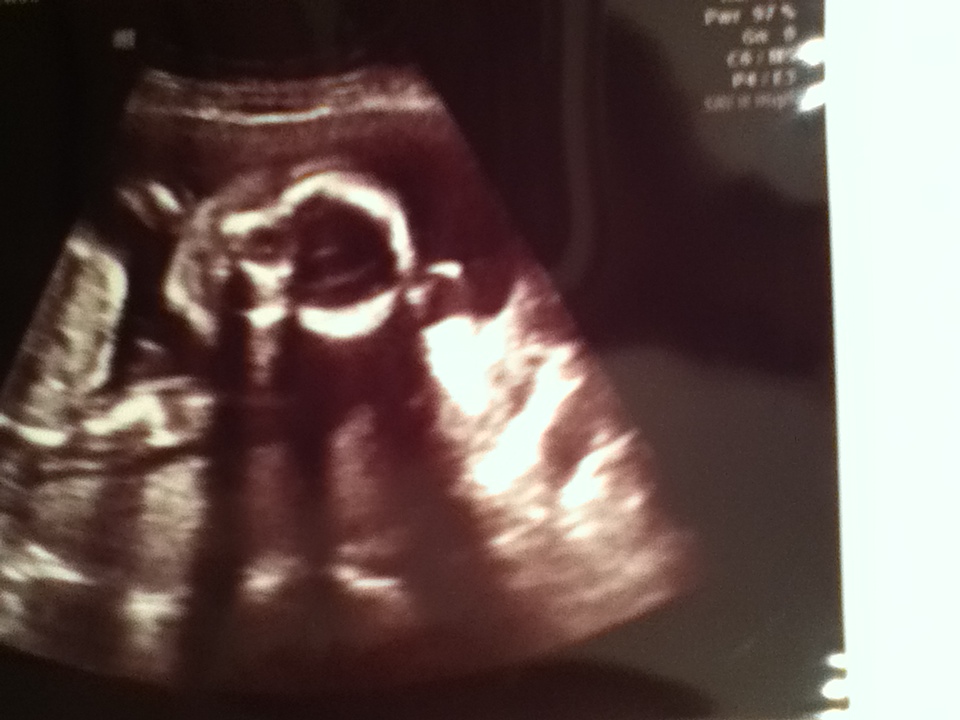 Keeping Up with the Joneses: 21 week ultrasound!!!