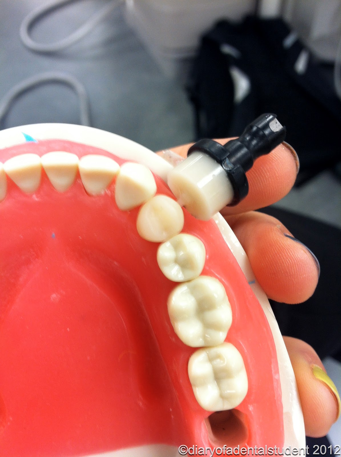 diary of a dental student: Milling My First Cerec Crown