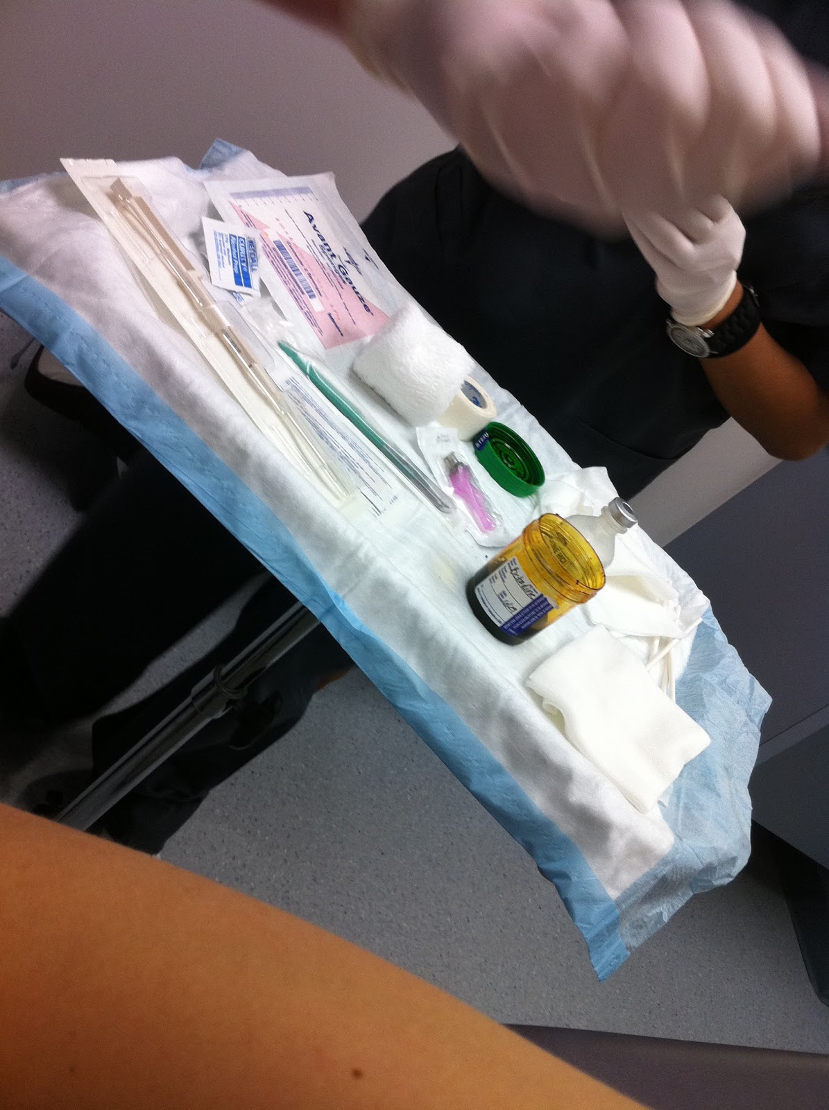 The Domestic Mommy Blog: Implanon Implant Insertion Review