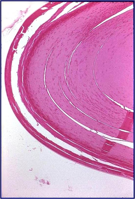 SOS BIOLOGIA CELULAR Y TISULAR: OJO. Eye