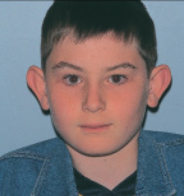 ENT for medical students: ENT PICTURES - EAR