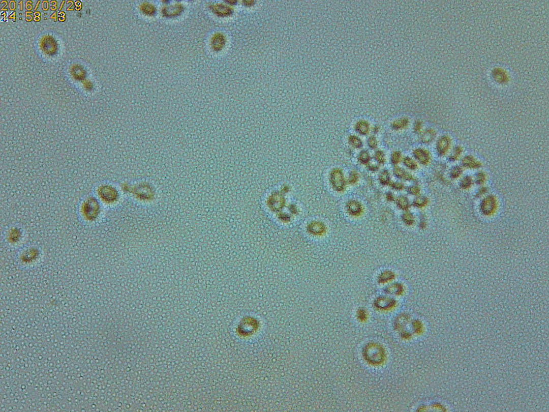 Yeast Cells Under Microscope 400x Micropedia